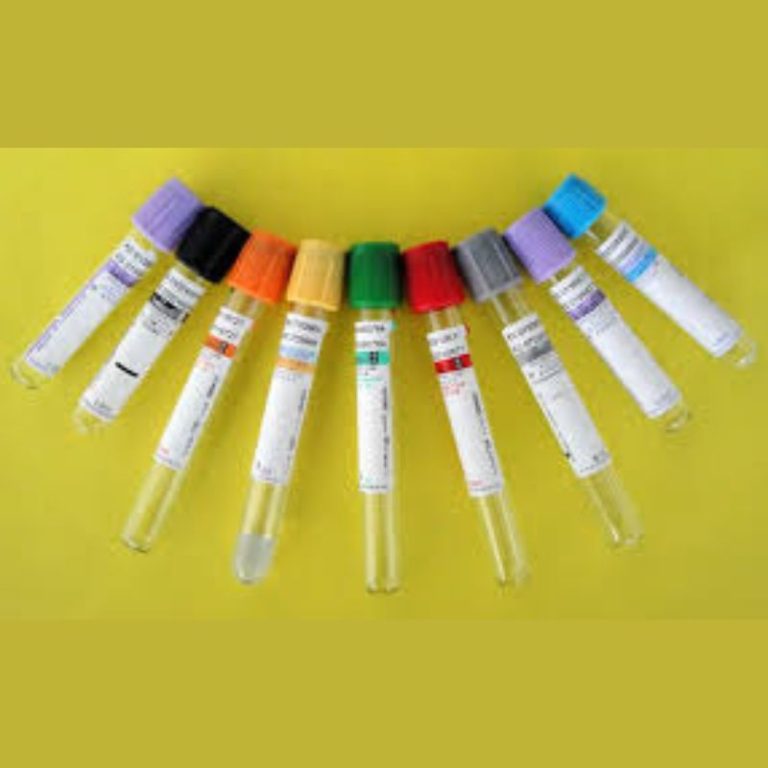 Evacuated Blood Collection Tubes – Safe & Reliable Blood Sampling – Lab ...